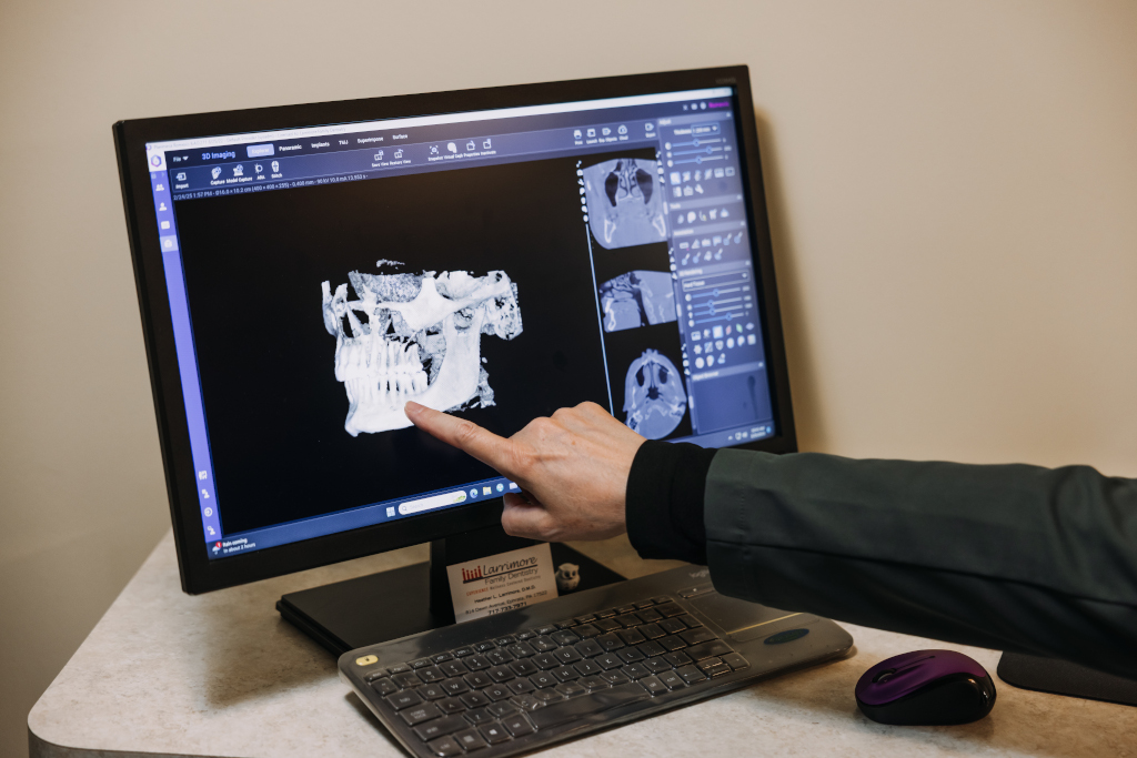 CBCT Scanner: Revolutionizing Dental Care at Larrimore Family Dentistry
